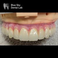 China Universal Multiple Choices Implant Cases Designed For Smooth Surface And Sterile Steam Cleaning for sale