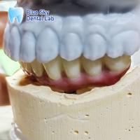 China Nature Surface Universal Compatible Multiple Choices Implant operation cases for Steam Sterilization for sale