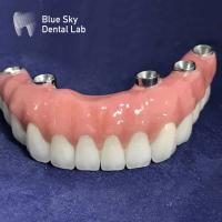 China Universal Autoclavable Rectangular Implant Cases Smooth Surface Silver Color for sale