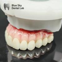 China Nature Dental Implant Cases Smooth Full Mouth Implant Case For Implant System for sale
