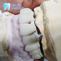China Implant Operation Cases / Implant Procedure Cases for Diverse Implant Choices and Sterilizations for sale