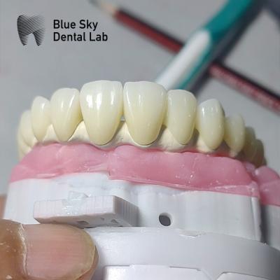China Universal Dental Implant Case Compatible With Multiple Implant Systems for sale