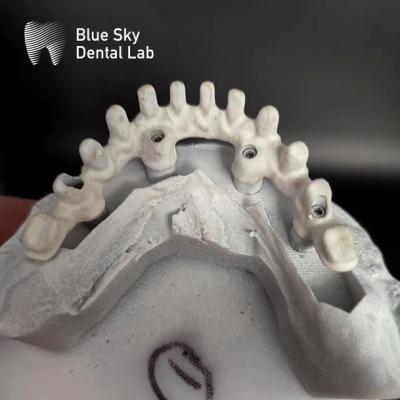 China Pure Titanium Frame Malo Bridge Customizable Blue Sky Implant for sale