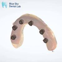 China Reusable Implant Direct Scan Body All In One Dental Scan Bodies for sale