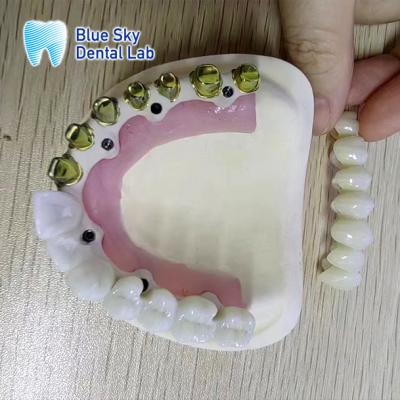 China Universal Full Arch Dental Implant Cases For Multiple Regular Implant System for sale