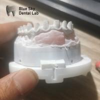 China Customizable Industrial Malo Bridge In Silver And Gold Malo Implant Bridge for sale