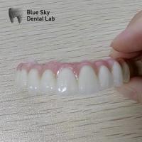 China Nature Implant Procedure Cases with Universal Compatibility and Optimal Performance for sale