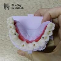 China Implant Cases with Sleek Surface for Optimal Surgical Outcomes for sale