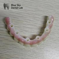 China Nature Implant Procedure Cases with Universal Compatibility and Optimal Performance for sale