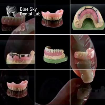 China Universal Customized Dental Titanium Bar  With Acrylic Denture for sale