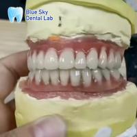 China Full Upper And Lower Titanium Bar Blue Sky Dental Implants for sale