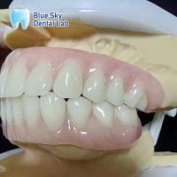 China Bluesky Temporary Acrylic Partial Denture Full Upper And Lower Acrylic Denture for sale