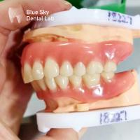 China Full Arch Removable Acrylic Denture Customizable Natural Looking Denture for sale