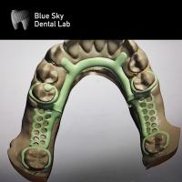 China Removable Partial Denture Metal Framework Partial Denture Framework Design for sale