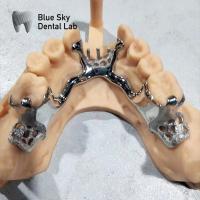 China Skelete Chrome Metal Partial Denture Printed CoCr Denture Design for sale