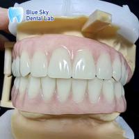 China Bluesky Temporary Acrylic Partial Denture Full Upper And Lower Acrylic Denture for sale