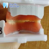 China Resin Acrylic Removable Partial Denture With Clasps And Full Acrylic Denture for sale