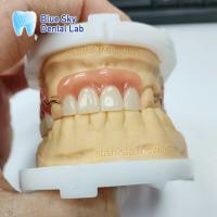 China Smile Restoration Partial Acrylic Denture with clasps for sale