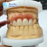 China Smile Restoration Partial Acrylic Denture with clasps for sale