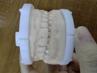 China Plastic Implant Cases for High Durability in Long-lasting Dental Implant Storage and Transport for sale