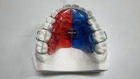 China 2.4 Ounces Implant Cases for Dental Sterilization Steam Sterilization for sale