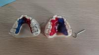 China High Durability Dental Implant Case Artificial Implantation Cases for Dental Professionals for sale