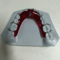 China 2.4 Ounces Removable Prosthesis Implant Cases with High Durability for sale