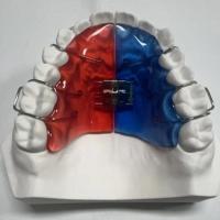 China Stainless Steel Acrylic Screw Expander Orthodontic Treatment Removable for sale