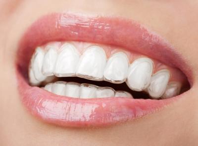 China TPU Transparent Dental Orthodontic Sheet 17x18cm 0.63mm Anti Fouling Material for sale