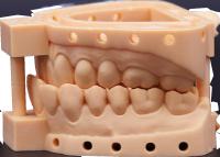 China Smooth Surface Dental 3D Printer Resin Medical Class Quick Rebound Odorless High Precision for sale