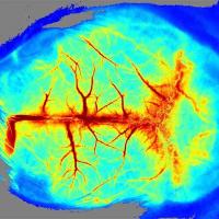 China RWD RFLSI-ZW Laser Speckle Contrast Imaging System for sale