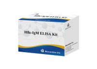 China ISO13485 HBc IgM Test Kit Hepatitis B Core Antibody Igm Test for sale