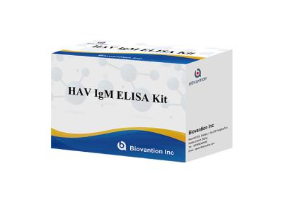 China Plasma IgM 96pcs Elisa Test Kit HAV Diagnos Antibody Test Kit for sale