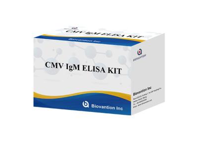 China Laboratory Or Hospital High Precision Antibody IgM To Cytomegalovirus (CMV) ELISA TEST KIT for sale