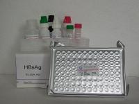 China ELISA detection reagent kit High Accuracy HBsAg Elisa Test Kit for sale