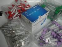 China Tuberculosis-Interferon Gamma Release Assay Elisa kit Manufactured by Biovantion for sale