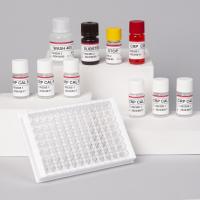 China Antibodies to Nuclear (ANA) IgG ELISA Test Type Elisa Kit for sale