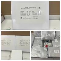 China H Pylori  ELISA Test Kit 480test/kit Elisa Screening Kit Results for sale