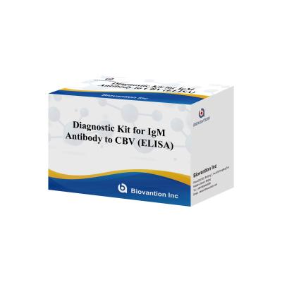 China 18 Months Shelf Life Enzyme-Linked Immunosorbent Assay Test For IgM Antibody To CBV for sale
