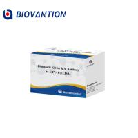 China Accurate and Timely ELISA Test Kit for Specificity Medical Diagnosis and Evaluation for sale