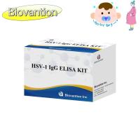 China HSV 1 IgG Torch ELISA Test Kit  High Hot Sale Diagnostic Reagent IVD for sale