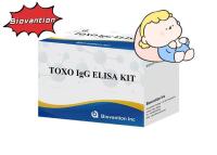 China Torch High Sensitivity TOXO IgG ELISA Test Kit  Hospital Test Pregnancy Check for sale