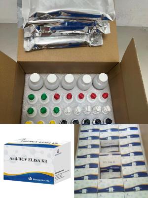 China Anti-HCV  Antibodies To Hepatitis C Virus Enzyme-Linked Transport Time Short for sale
