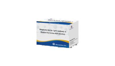 China Diagnostic Kit For Human Parvovirus B19 IgG elisa test kit Antibody For Serum Samples for sale