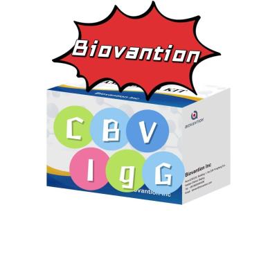 China Diagnostic Kit For CBV-IgG Antibody ELISA test kit Serum Test KiT for sale
