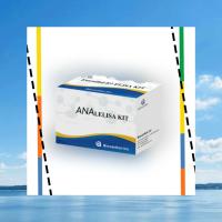 China Anti ANA IgG ELISA Test Kit  Anti Nuclear IgG Antibody Qualitative Detection for sale