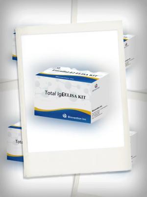 China Total IgE Antibody ELISA Test Kit Serum / Plasma In Vitro Diagnostic for sale