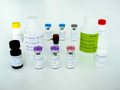 China Accuracy And Sensitive Elisa Test Kit For Fast And Easy Detection TB IGRA ELISA DIAGNOSIS for sale