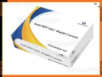 China Sensitivity HIV 1/2 Detection Reading Time 5 Minutes 25 Tests for sale