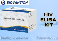 China Biovantion 4th Generation HIV Ab Ag ELISA Kit with High Sensitivity and 96 Tests for Early Detection for sale